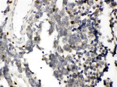 Anti Runx3 Antibody Picoband™ Bosterbio