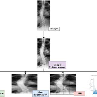 Feature Extraction Methods For Radiographic Images Download Scientific Diagram