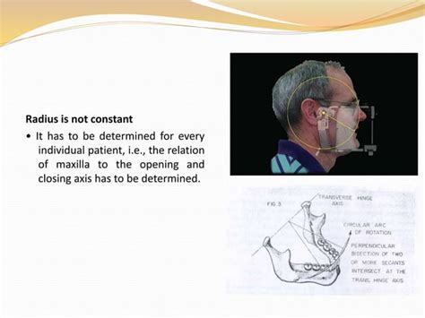 Hinge Axis And Facebow Pptx Dental Health Diseases And Conditions
