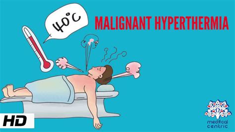Malignant Hyperthermia Education Inspirational Education