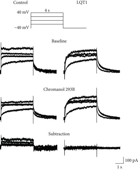 Patch Clamp Analysis Of Cardiomyocytes From Control And Lqt Ipsc Download Scientific Diagram