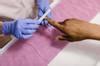 Healing Amputated Fingers Time And Nail Recovery Process Nailicy