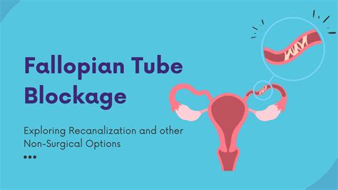 Is Sex Good For Enlarged Prostate Understanding Risks And Benefits