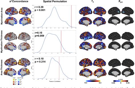 Figure 2 From The Genetics Of Cortical Myelination In Young Adults And