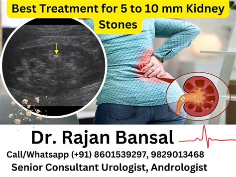 Side Effects Of Alpha Blockers Understanding Risks And Benefits In Urological Practice