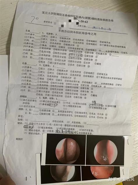 复旦耳鼻喉科医院的二位医生误诊致母亲鼻咽癌晚期 知乎