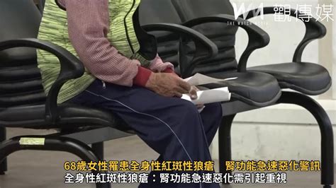 68歲女性罹患全身性紅斑性狼瘡 腎功能急速惡化警訊 YouTube