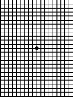 Macular Degeneration Test Online And Visual Acuity Test Information