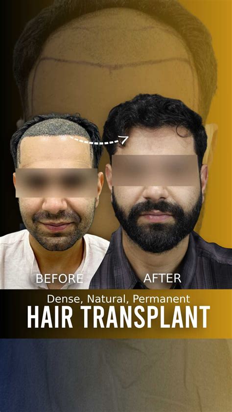 Dr Adarsh Tripathi Dradarshtripathi • Instagram Photos And Videos