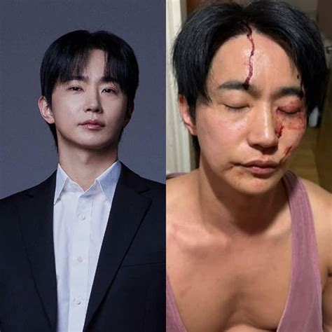 [종합] 전여친 폭행에 성병 옮겨 폭로에…전호준 피 흘리는 사진 녹취록 공개