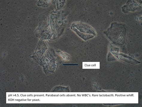 Vaginal Microscopy Summary Table B Findings Associated With Elevated Ph Vulvovaginal Disorders
