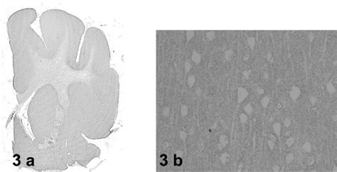 Cerebral Cortex Of A Control Case Glt 1 Immunohistochemistry A Download Scientific Diagram