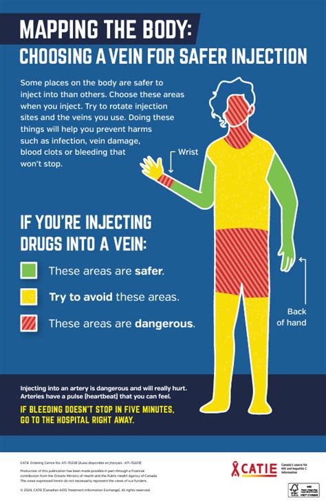 Mapping The Body Choosing A Vein For Safer Injection Catie Canadas Source For Hiv And