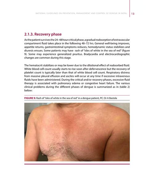 Dengue Guidelines Pdf Infectious Diseases Diseases And Conditions