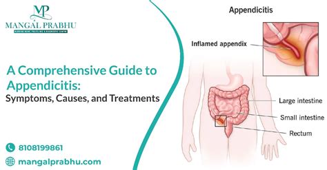 All You Need To Know About Appendicitis