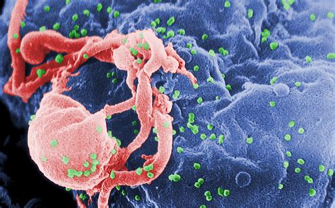 Hiv Infection Leaves A ‘memory In Cells Healthcare Hygiene Magazine