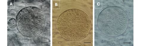 Oocyte Cells After Denudation Are Demonstrated At Different Stages Of Download Scientific