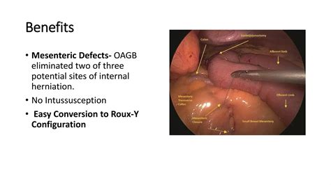 Safety In Bariatric Surgery Pptx