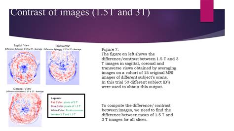 Github Saisjoshiclassificationalzheimersdisease3dvisiontransformer