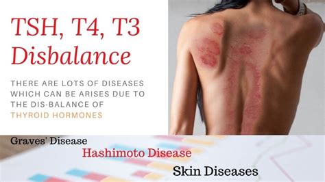 TSH T T Normal Range Helpful Things You Need To Know Right Now BioWellBeing