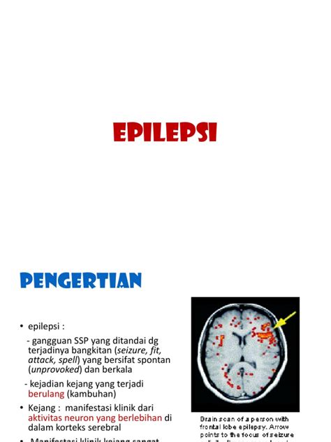 Epilepsi Klasifikasi Diagnosis Dan Tatalaksana Pdf