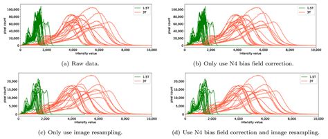 Impact Of Preprocessing Methods On Image Histograms Of Brain Mri Images