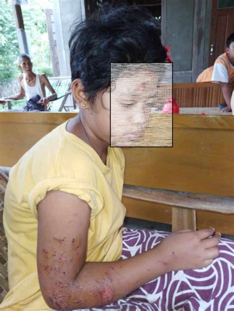 ထီးလင်းတွင် တိုက်ပွဲ ဖြစ်ပွားခြင်းမရှိဘဲ စစ်တပ်က လေကြောင်းဖြင့် ဗုံးကျဲ တိုက်ခိုက်မှု အမျိုးသမီး