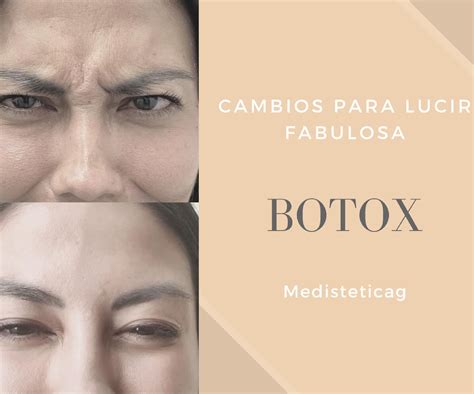Botox— 💉 Al Inyectar Botox En La Dr Alonso González Facebook