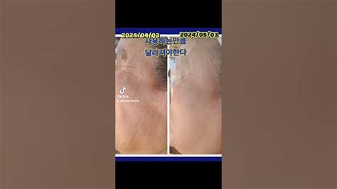 달라져야한다 달라진다 남다르대중성 바르는순간 변화하기시작 케이셀채움 슬림케이셀 슬림앤슬림 Newbaba Youtube