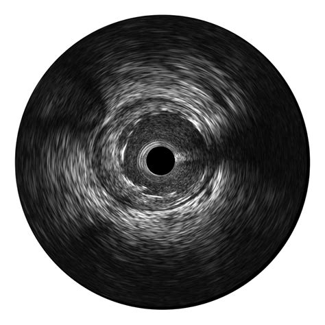 V Reader® V10 心血管介入 深圳开立生物医疗科技股份有限公司