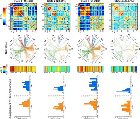 Findings Of Dynamic Brain Activity Connectivity States Four Brain Download Scientific Diagram