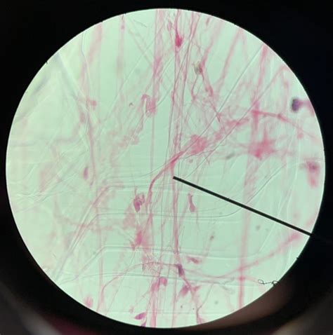 One Flashcards Quizlet