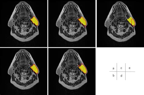 Comparison Of Manual Segmentation And A 25d Generative Adversarial Download Scientific