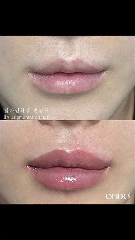 입술반영구 애교살반영구 인중축소 결눈썹 반영구수강 내 입술색 그대로 확장 입술반영구 Lip Augmentation Permanent Make Up 세계