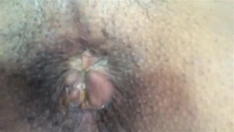 Stinky Pulsating Asshole I