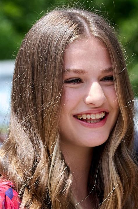 What Happened To The Problem With Princess Leonor S Teeth Artofit