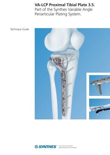 Proximale Tibia