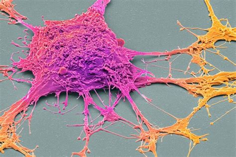 Premium Photo 3d Illustration Of Neurons On Colorful Background Model Of Nervous Cells Brain