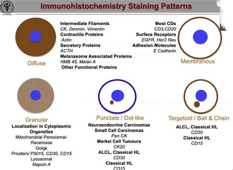Dr Lahari Pujari On Linkedin Ihc Staining Pattern