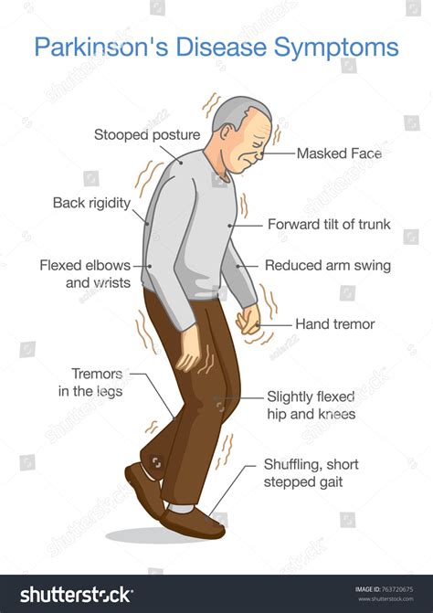 Parkinsons Disease Symptoms Illustration About Health Stock Vector