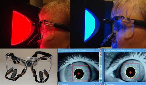 Chromatic Pupil Responses Ophthalmology
