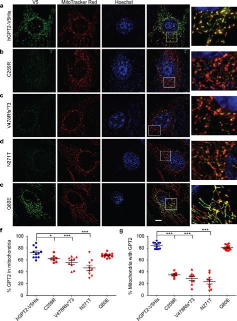 Subcellular Localization Of Gpt2 Mutants In Cultured Cells Ae