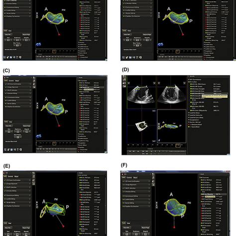 Illustrative Example Of Three Dimensional Quantitative Analysis Of