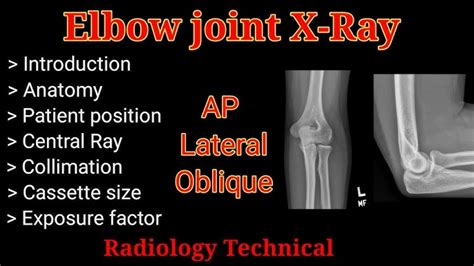 Abdomen Dorsal Decubitus X Ray Abdomen Radiography Part 4 50 Off