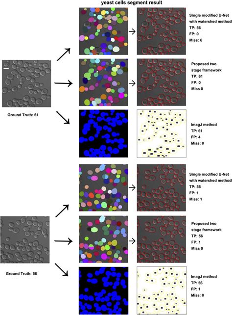 Example Of Yeast Cells Segmentation First Column Raw Dic Image