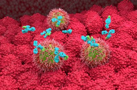 Monoclonal Antibody Therapy For Pancreatic Cancer Illustration Stock