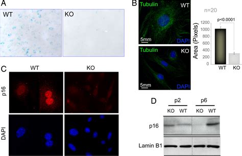 Runx Deficiency And Defective Subnuclear Targeting Bypass Senescence To Promote Immortalization