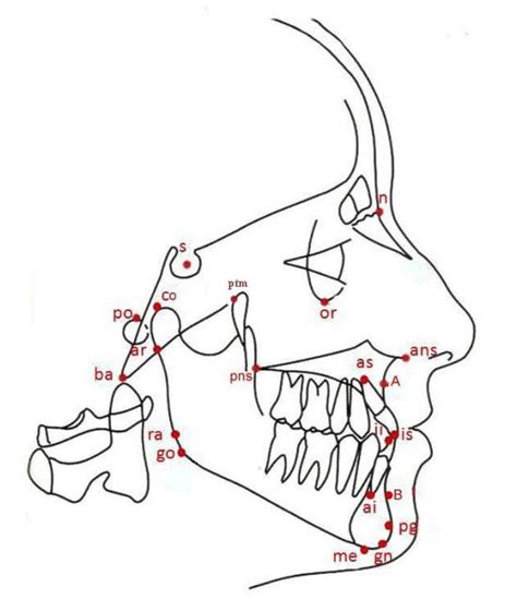 Cephalometric Landmarks Download Scientific Diagram