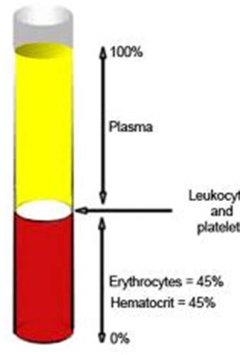 Hematology 9 Approach To Anemia And CBC Indices Flashcards Quizlet