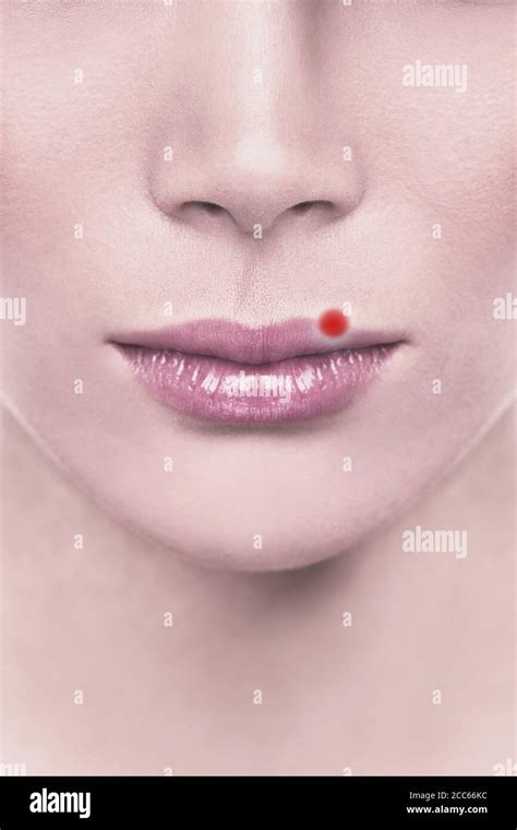 Maux De Bouche Banque De Photographies Et Dimages à Haute Résolution